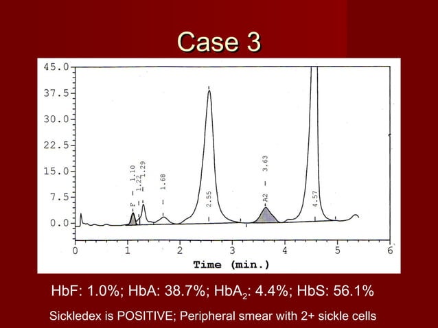 Interpreting Abnormal hemoglobin study | PPT