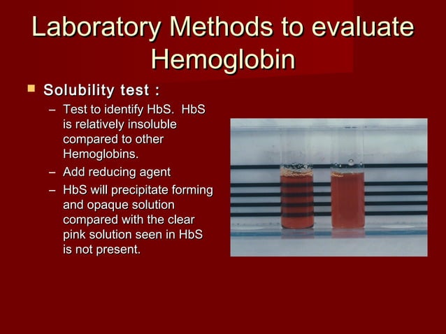 Interpreting Abnormal hemoglobin study | PPT