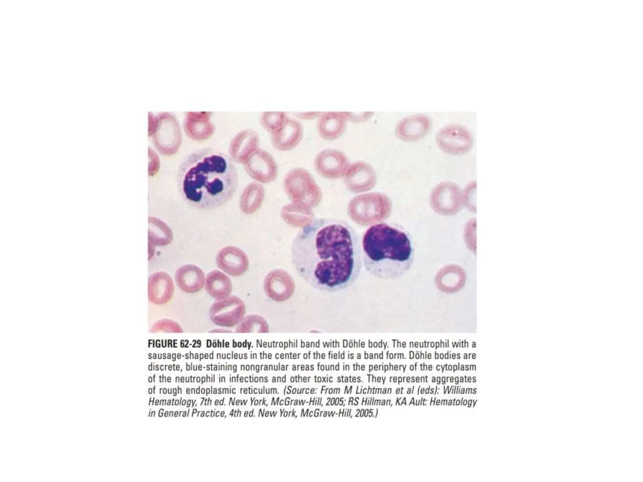interpreting peripheral blood smears.pptx