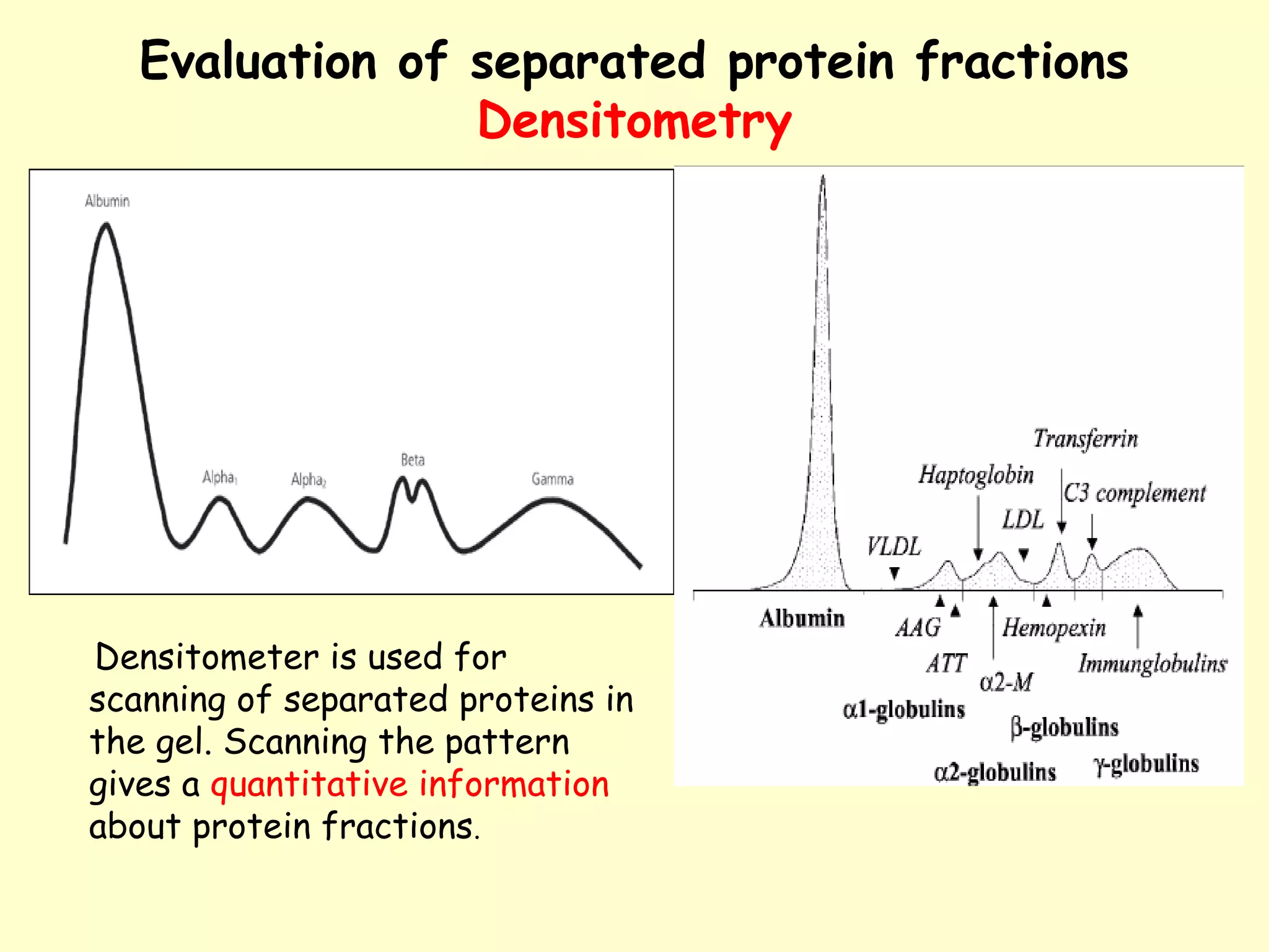 Interpreting serum protein electrophoresis | PPT