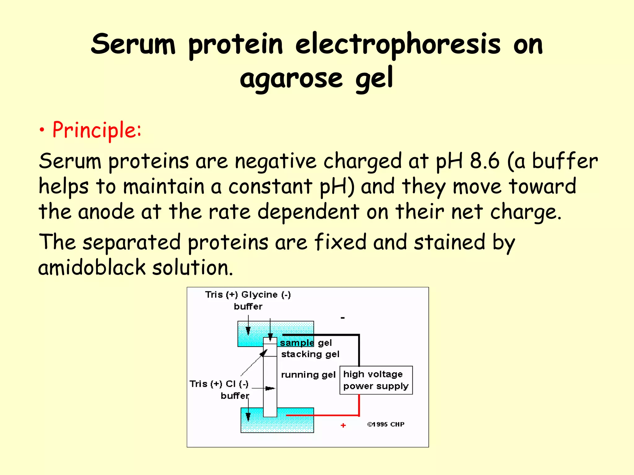 Interpreting serum protein electrophoresis | PPT