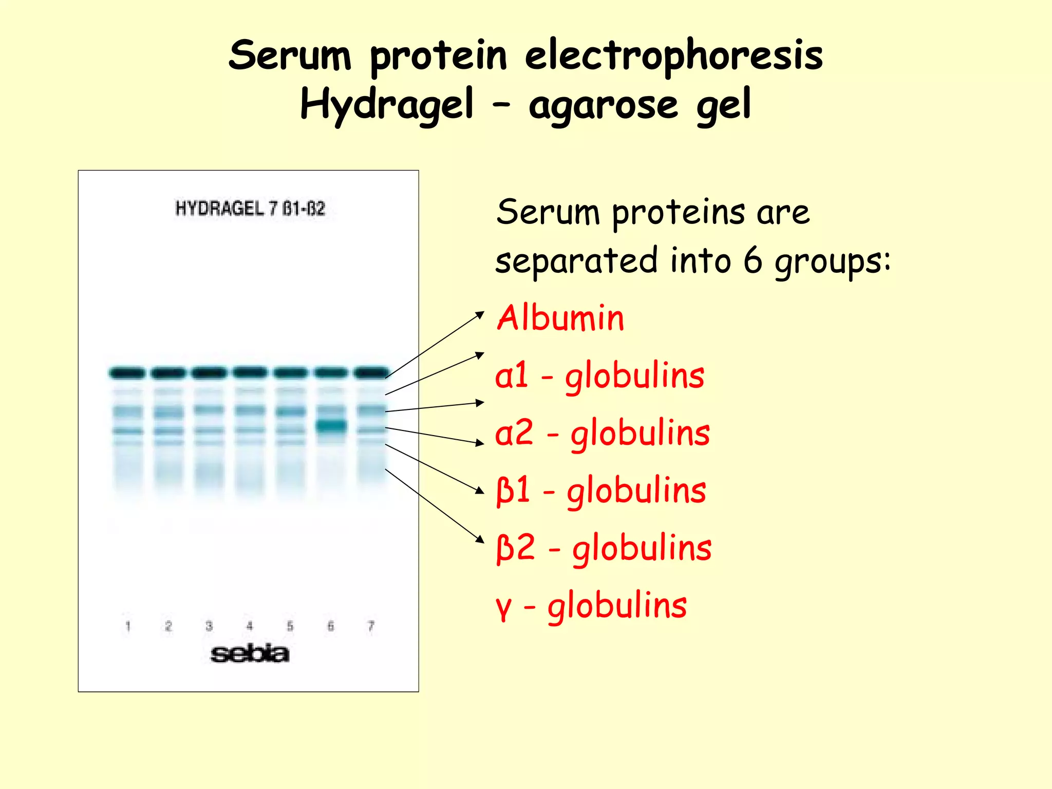 Interpreting serum protein electrophoresis | PPT