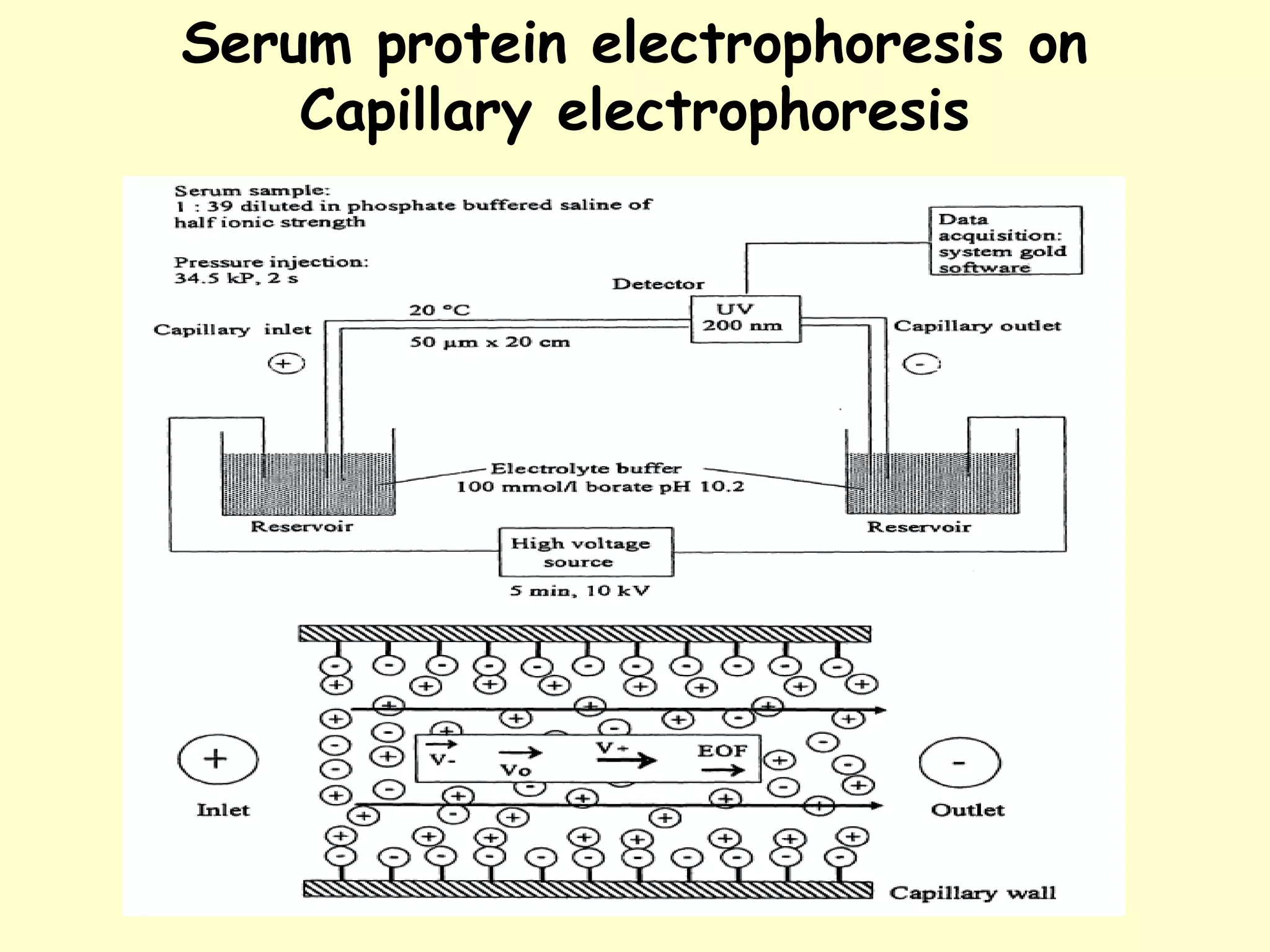 Interpreting serum protein electrophoresis | PPT