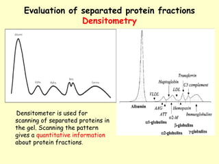 Interpreting serum protein electrophoresis | PPT