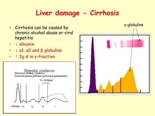 Interpreting serum protein electrophoresis | PPT