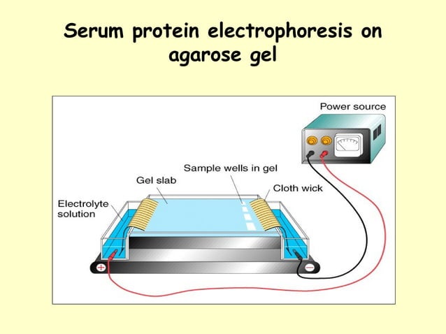 Interpreting serum protein electrophoresis
