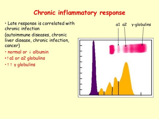 Electrophoresis Serum Protein Test Results Electrophoresis Serum Protein Test Results