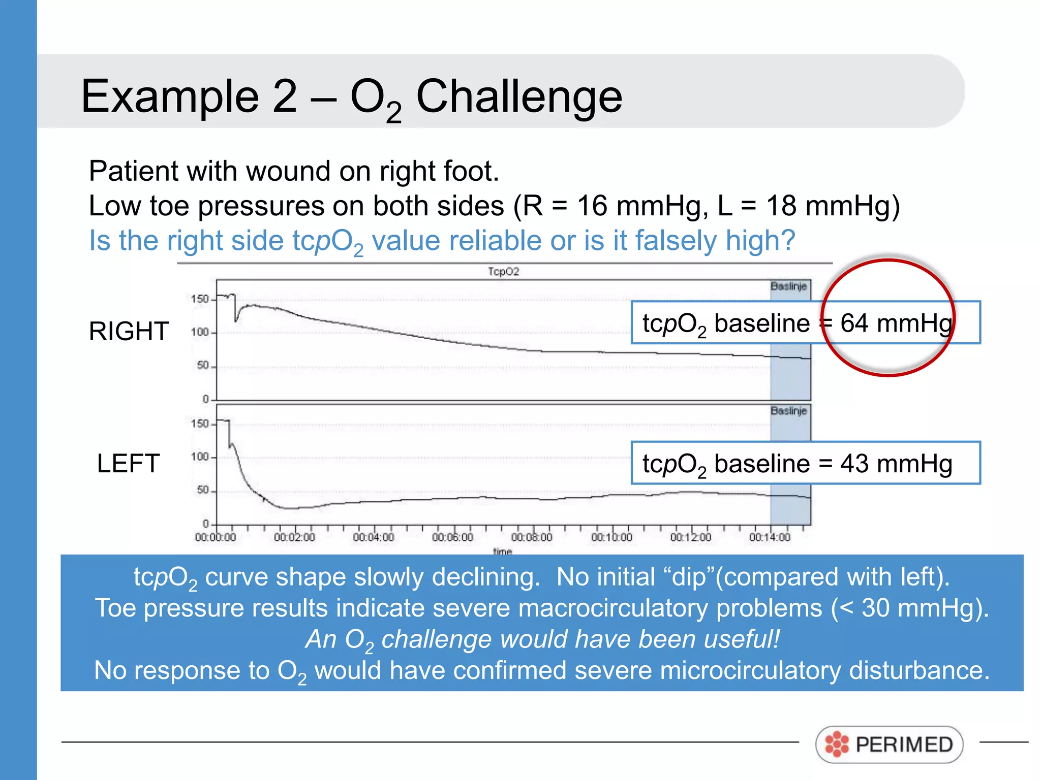 Interpreting tcpo2 curves and results | PDF