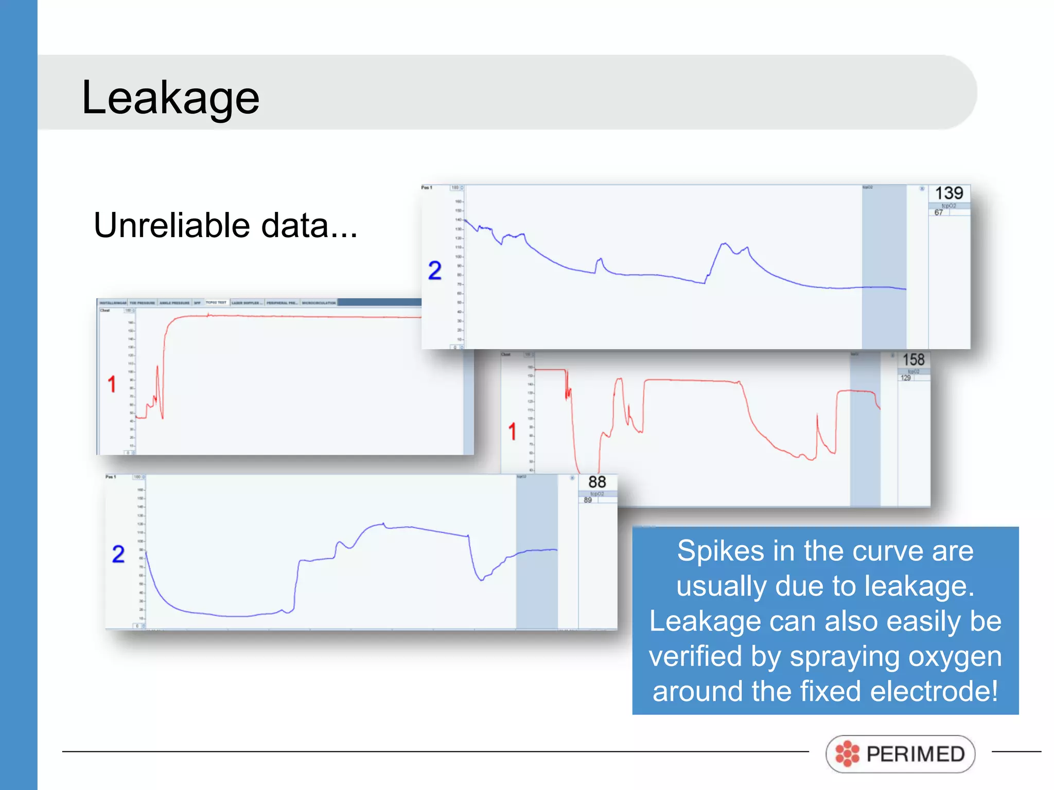 Interpreting tcpo2 curves and results | PDF
