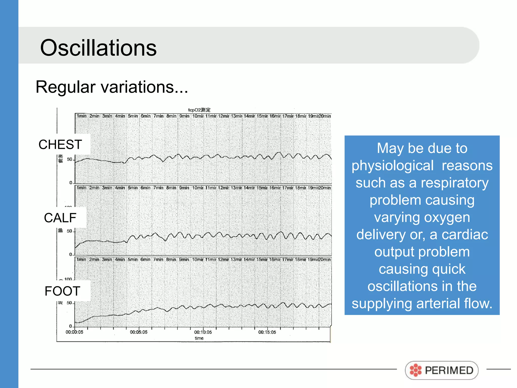 Interpreting tcpo2 curves and results | PDF