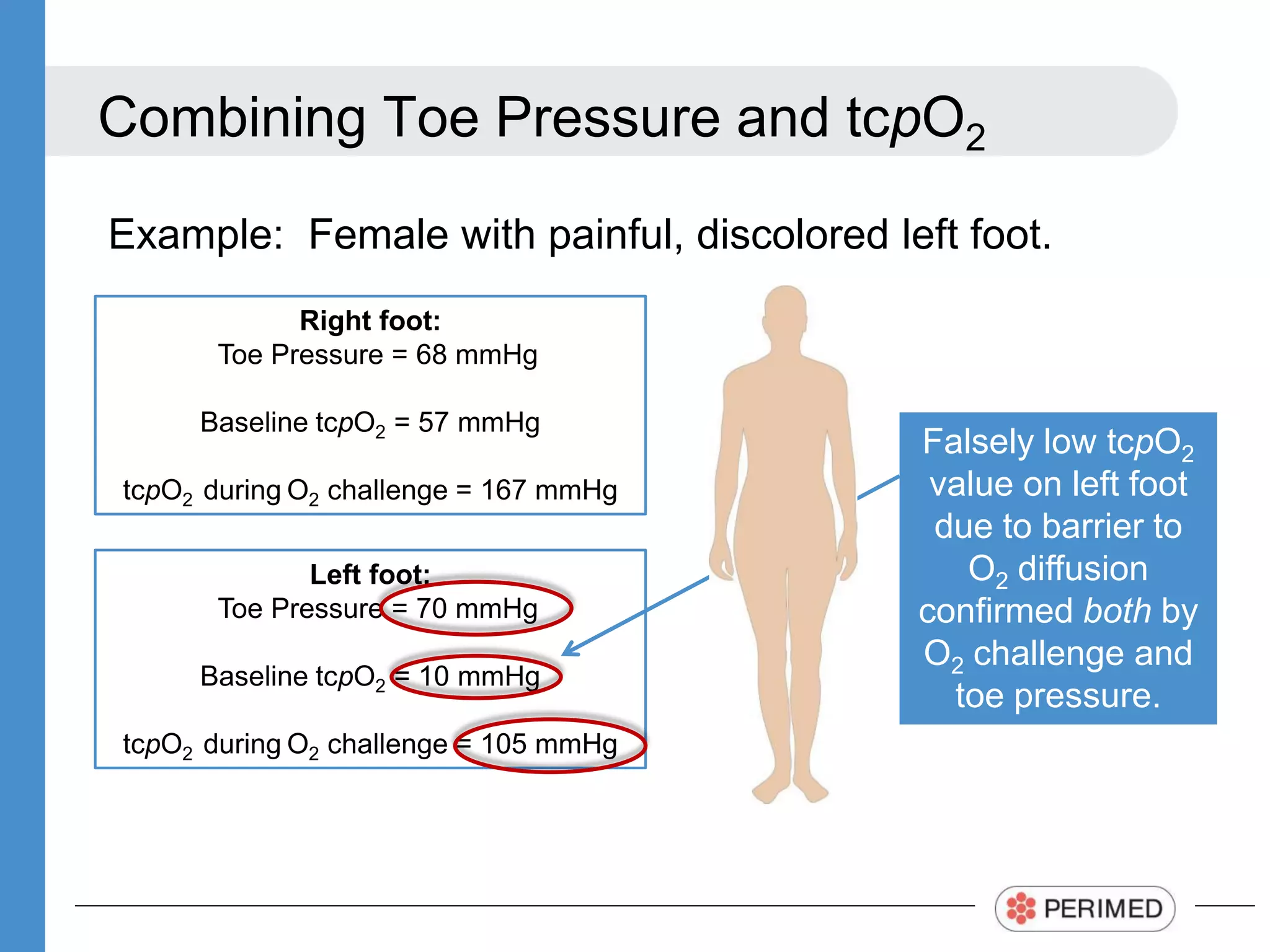 Interpreting tcpo2 curves and results | PDF