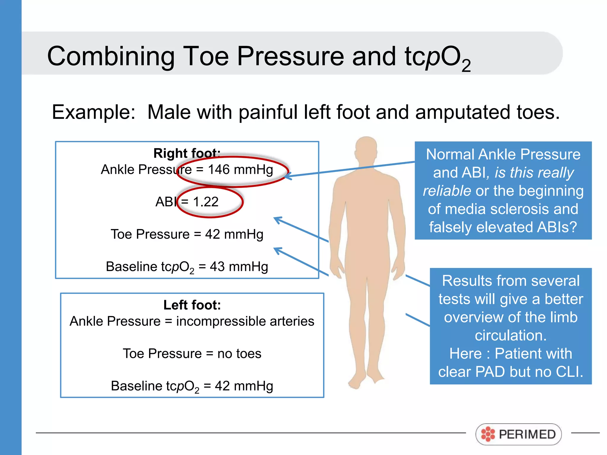 Interpreting tcpo2 curves and results | PDF