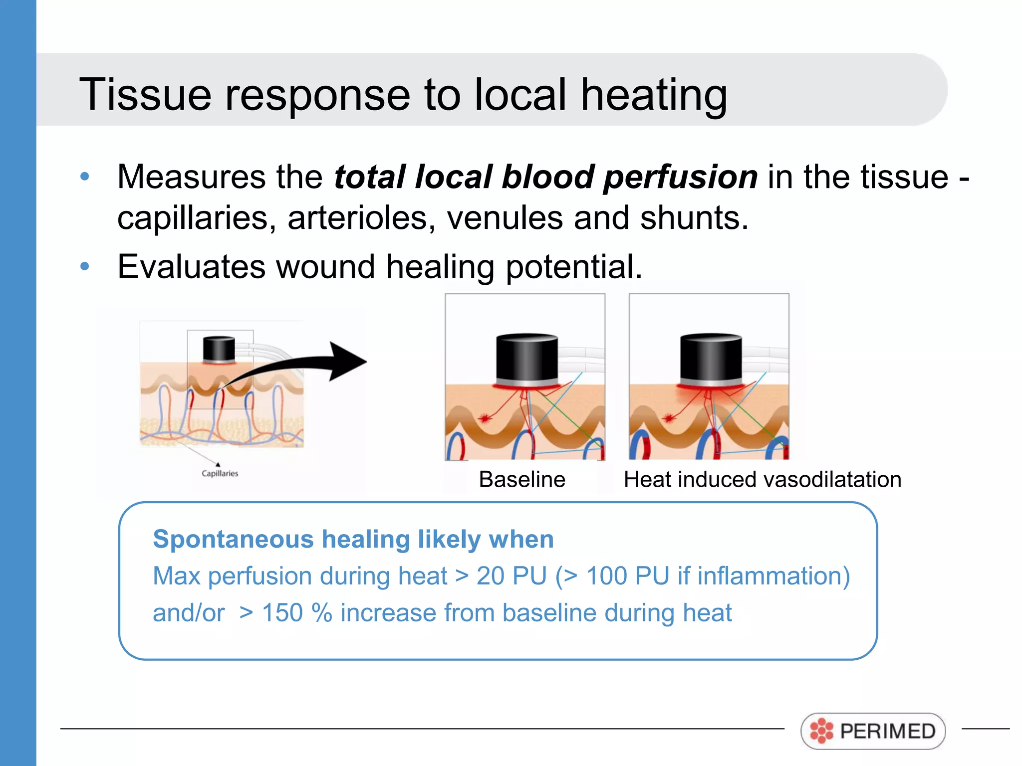 Interpreting tcpo2 curves and results | PDF