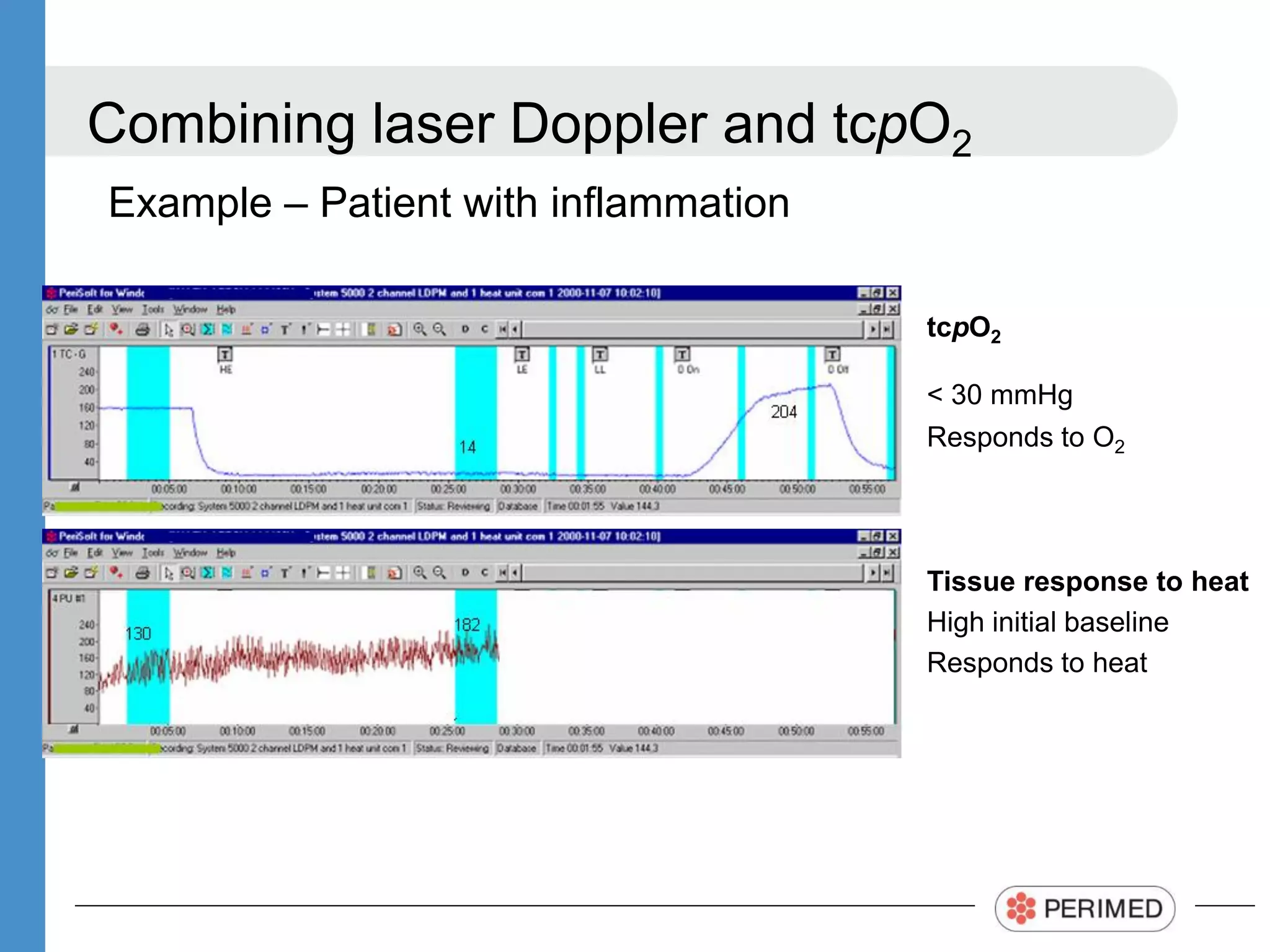 Interpreting tcpo2 curves and results | PDF