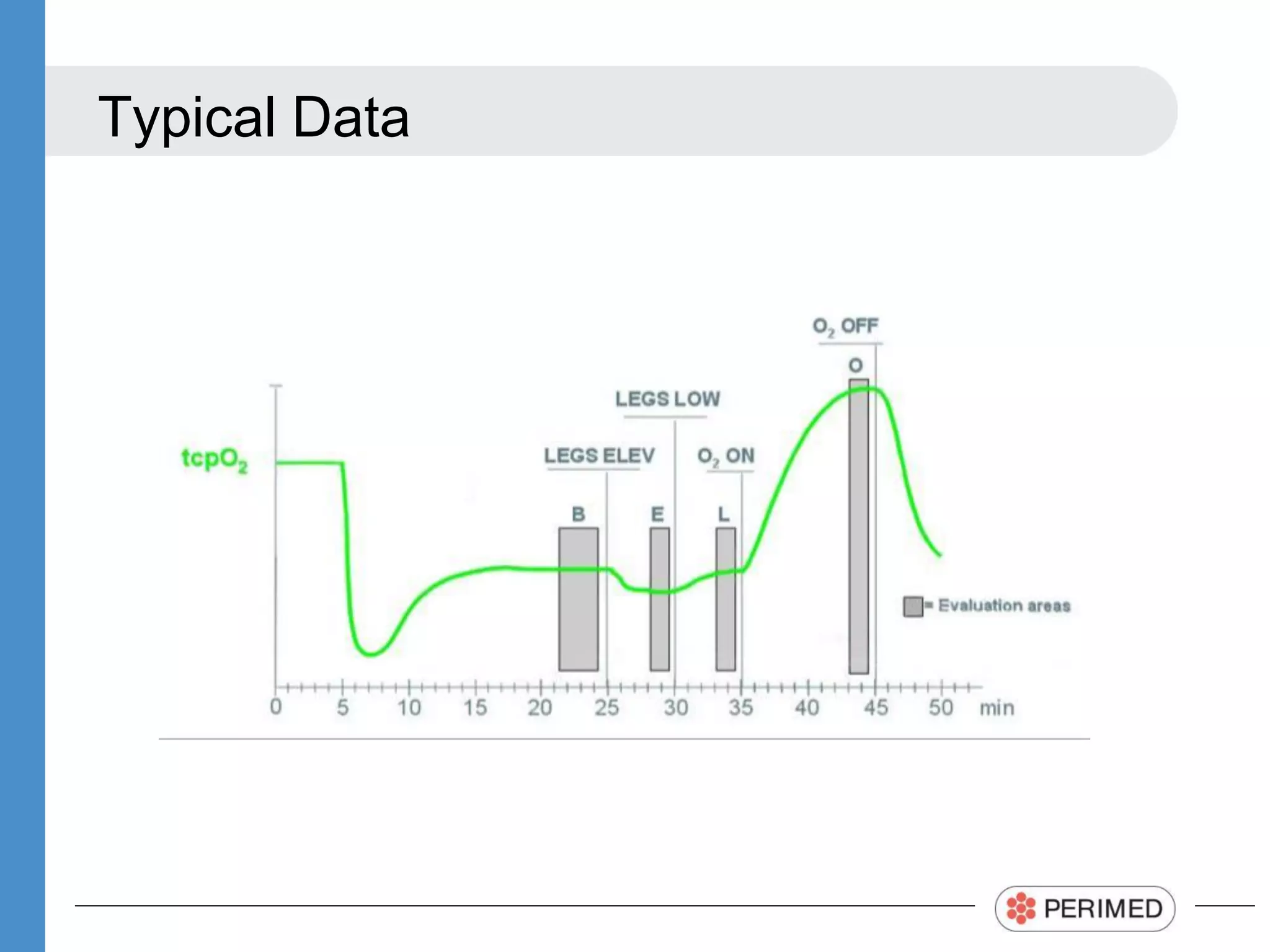 Interpreting tcpo2 curves and results | PDF