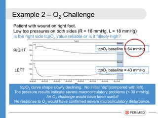 Interpreting tcpo2 curves and results | PDF