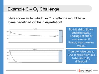 Interpreting tcpo2 curves and results | PDF
