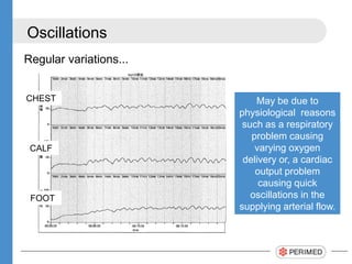 Interpreting tcpo2 curves and results | PDF