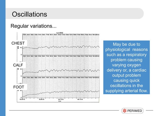 Interpreting tcpo2 curves and results | PDF