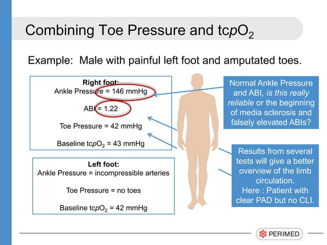 Interpreting tcpo2 curves and results | PDF