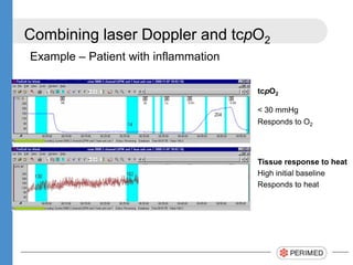 Interpreting tcpo2 curves and results | PDF