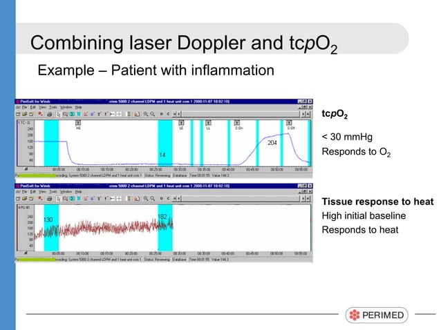 Interpreting tcpo2 curves and results | PDF