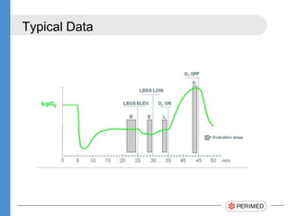 Interpreting tcpo2 curves and results | PDF