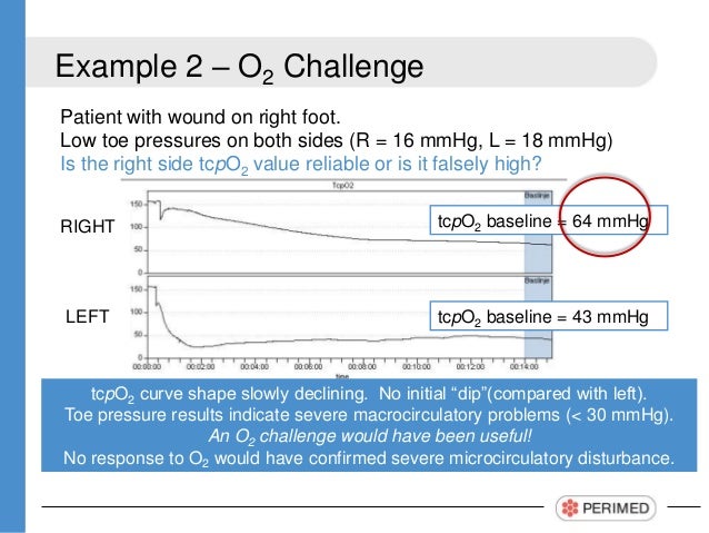 Interpreting tcpo2 curves and results