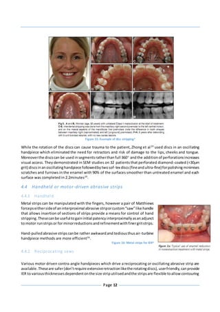 Interproximal enamel reduction / for orthodontists by Almuzian | DOCX