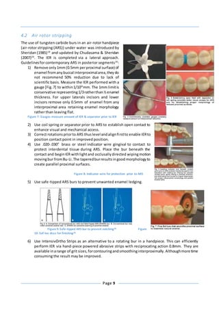Interproximal enamel reduction / for orthodontists by Almuzian | DOCX