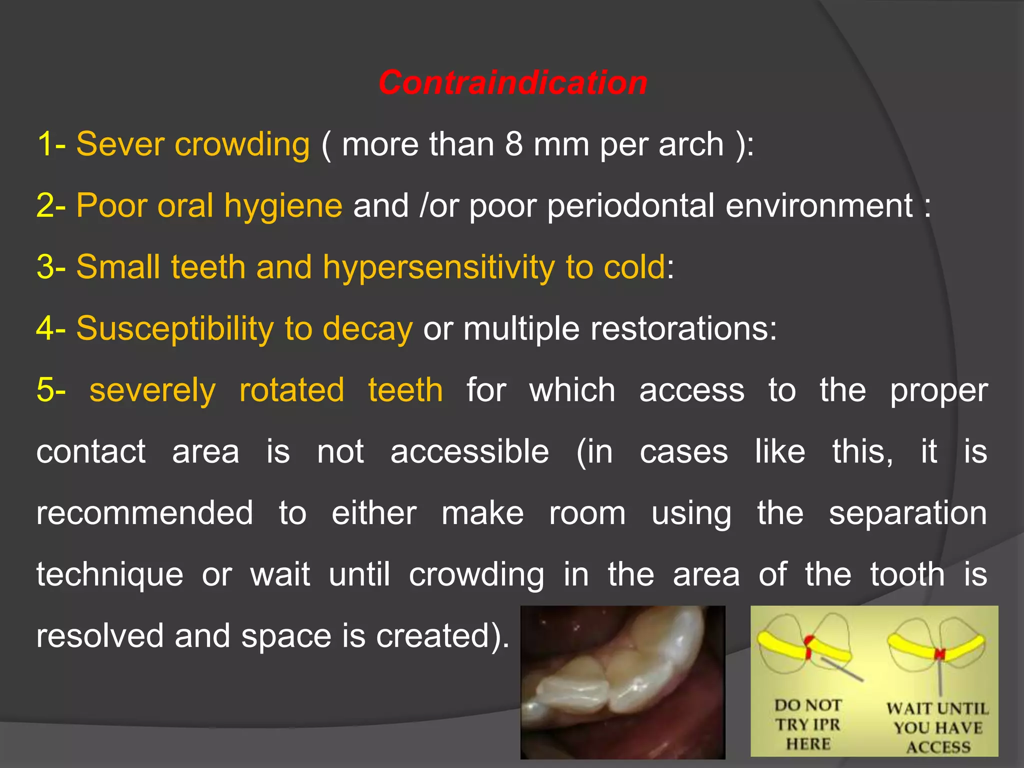 Interproximal Enamel Reduction (stripping) | PPTX