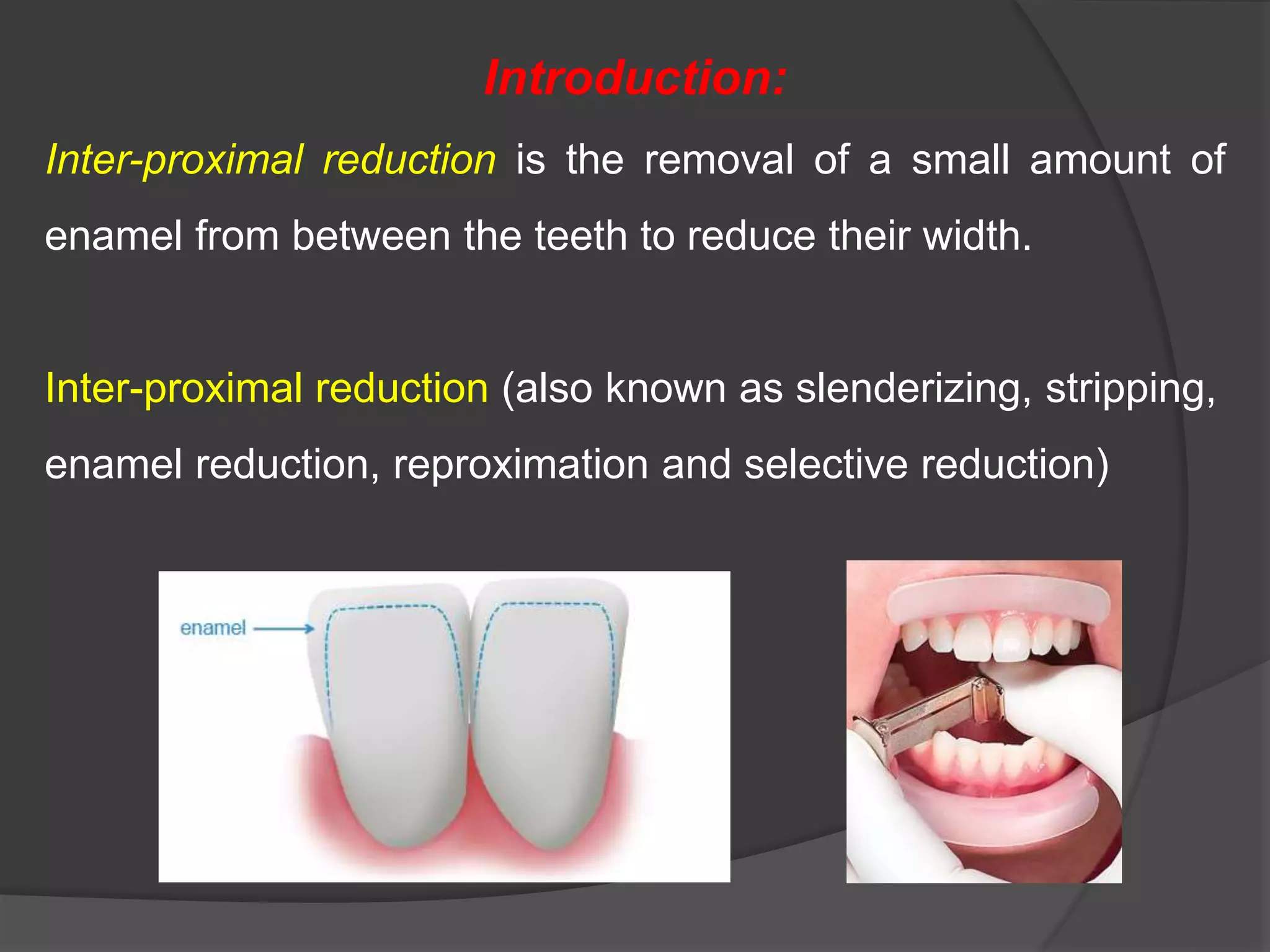 Interproximal Enamel Reduction (stripping) | PPTX