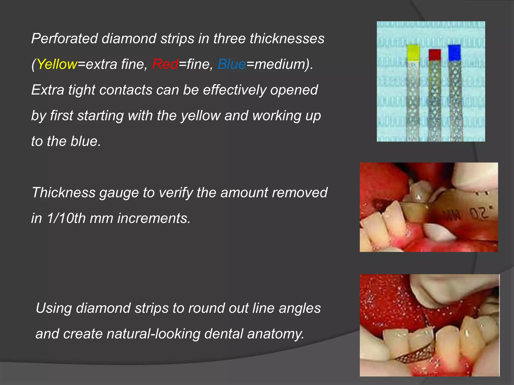 Interproximal Enamel Reduction (stripping) | PPTX