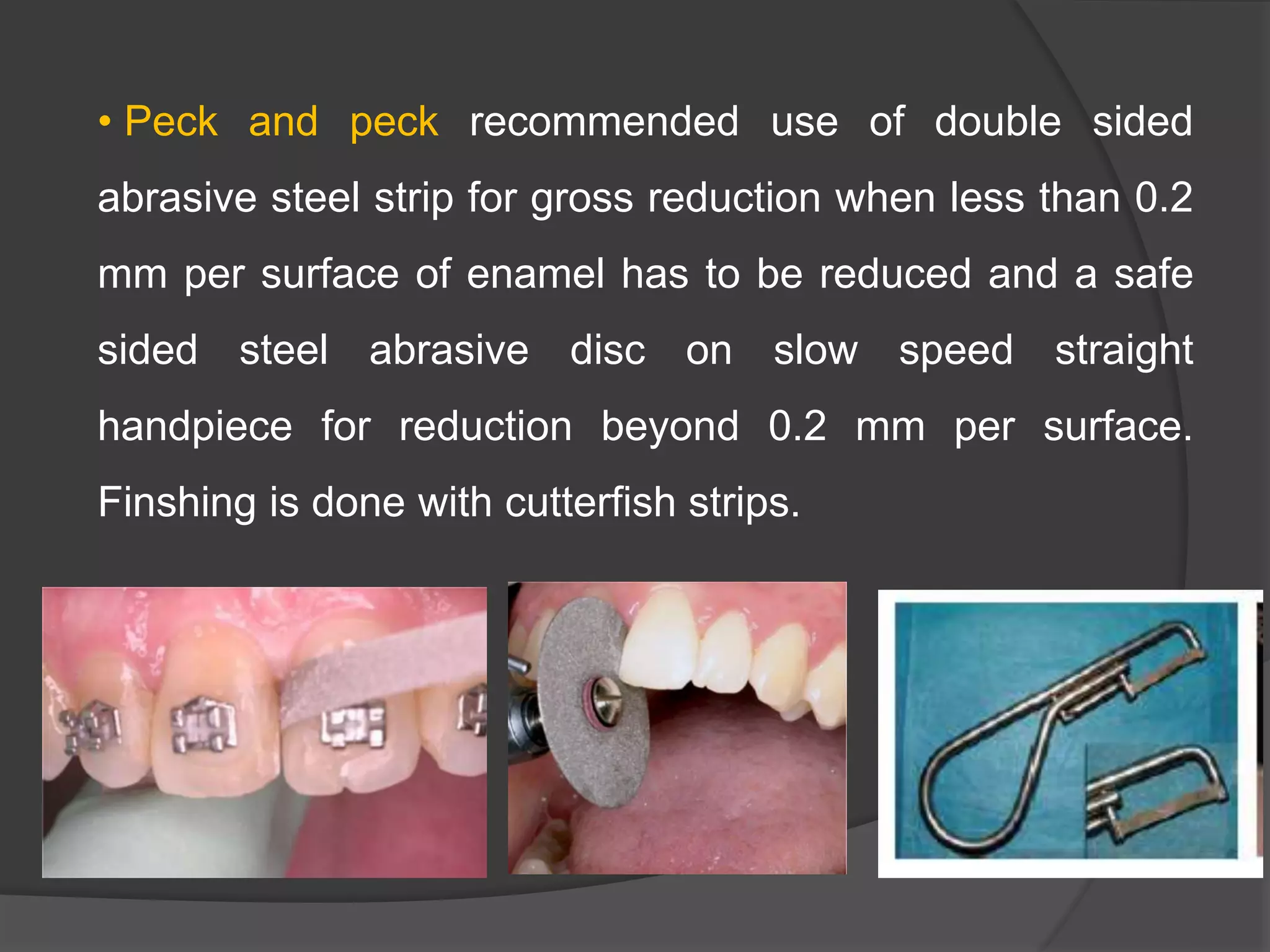 Interproximal Enamel Reduction (stripping) | PPTX