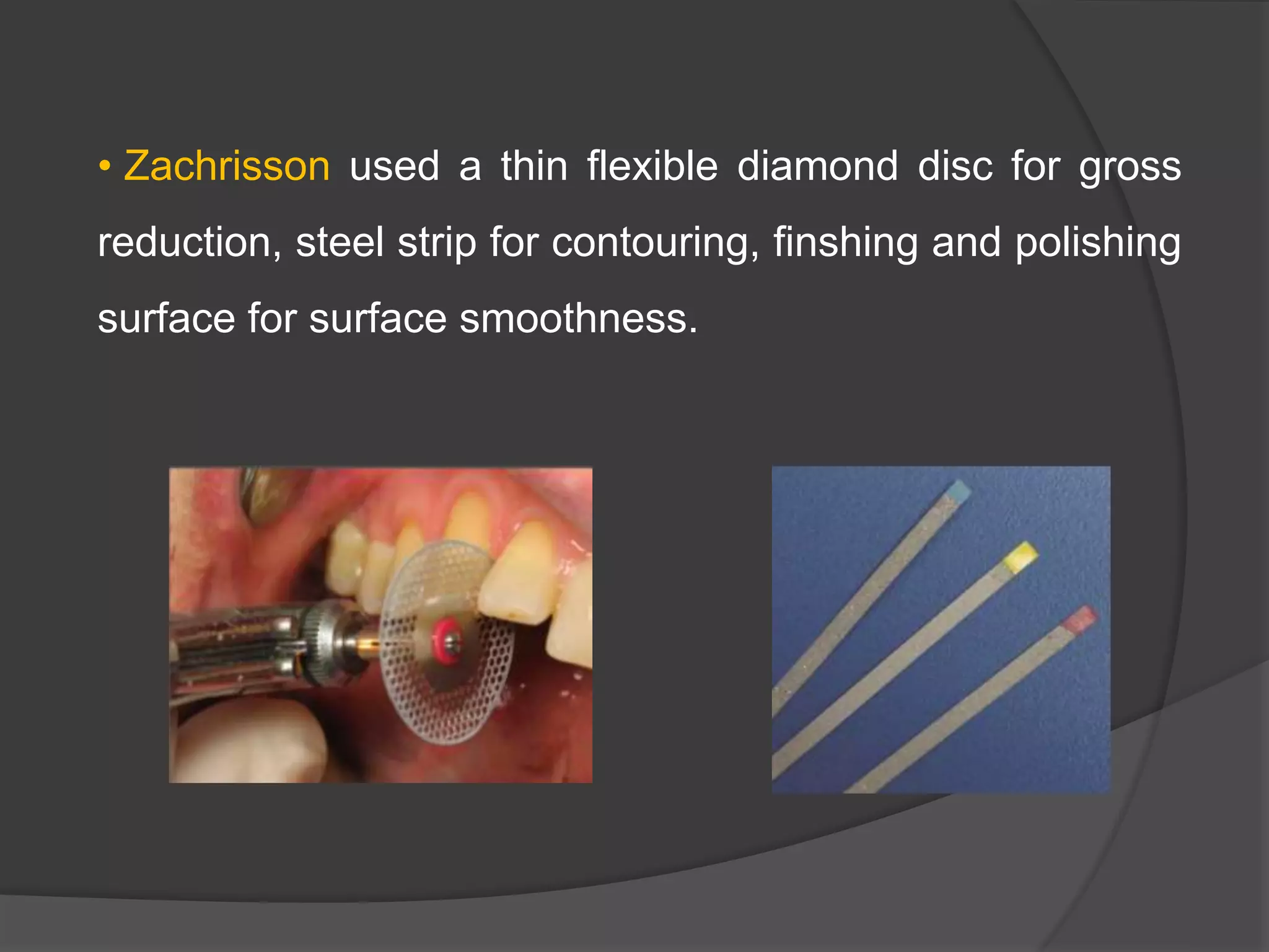 Interproximal Enamel Reduction (stripping) | PPTX