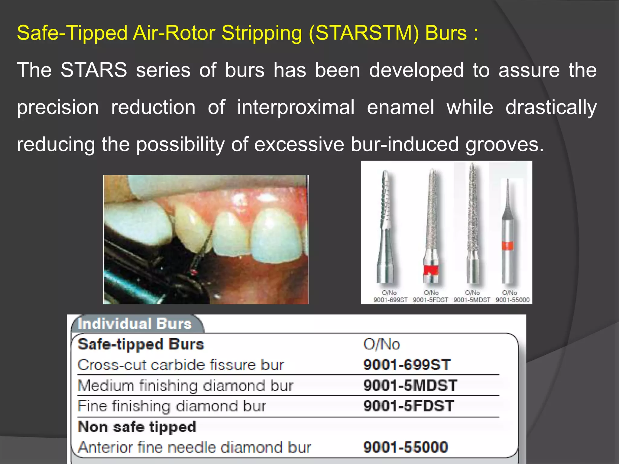 Interproximal Enamel Reduction (stripping) | PPTX
