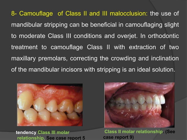 Interproximal Enamel Reduction (stripping) | PPTX | Dental Health ...