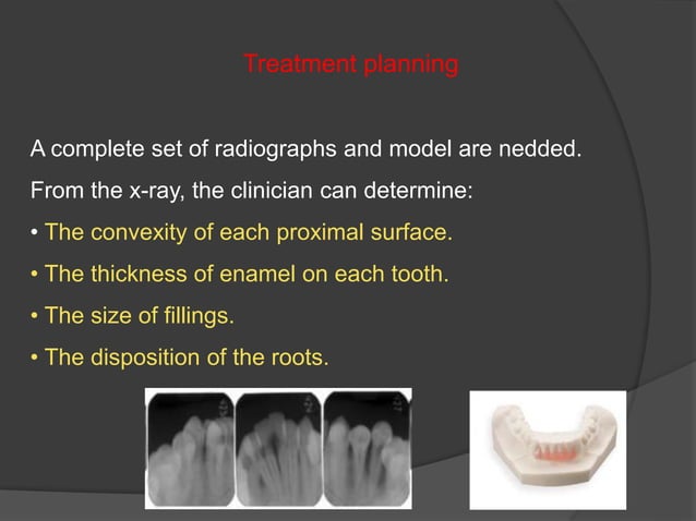 Interproximal Enamel Reduction (stripping) | PPTX | Dental Health ...