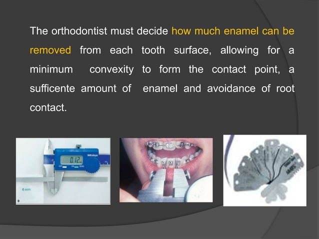 Interproximal Enamel Reduction (stripping) | PPTX | Dental Health ...