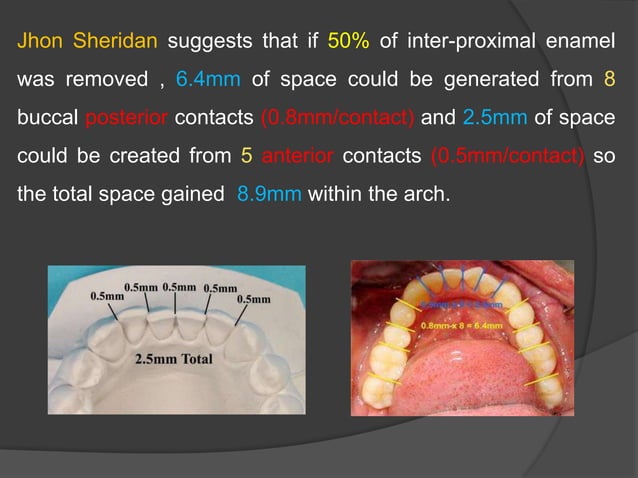 Interproximal Enamel Reduction (stripping) | PPTX | Dental Health ...