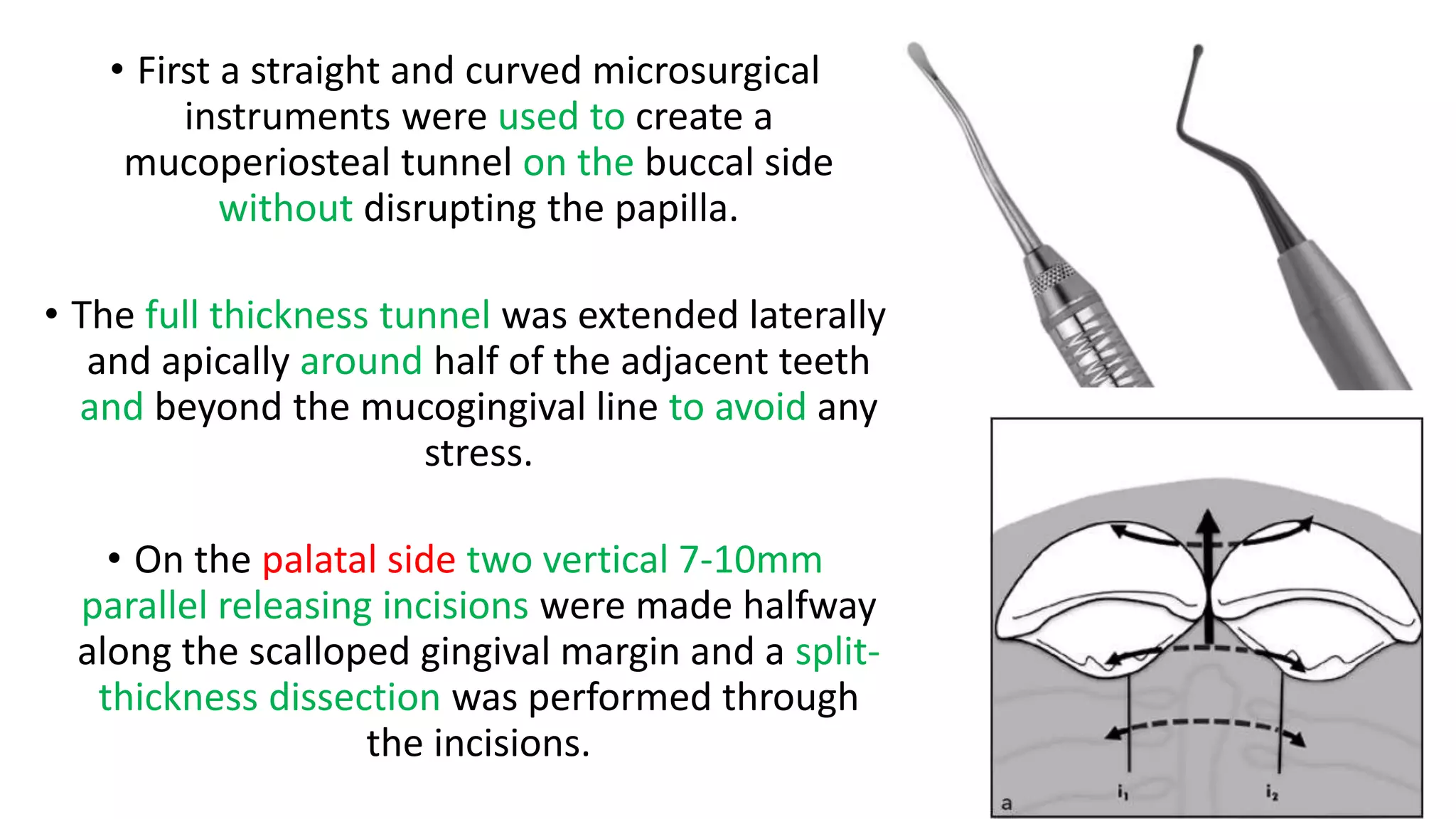 Interproximal tunneling with a customized connective tissue graft a ...