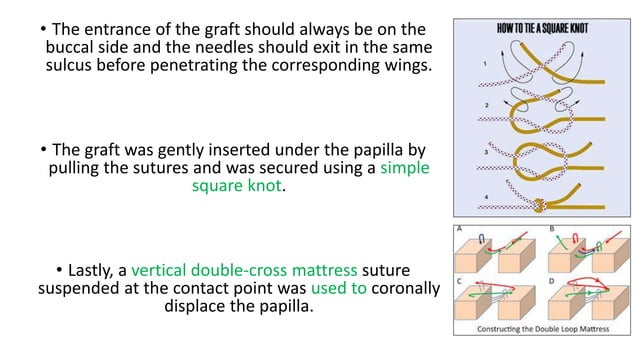 Interproximal tunneling with a customized connective tissue graft a ...