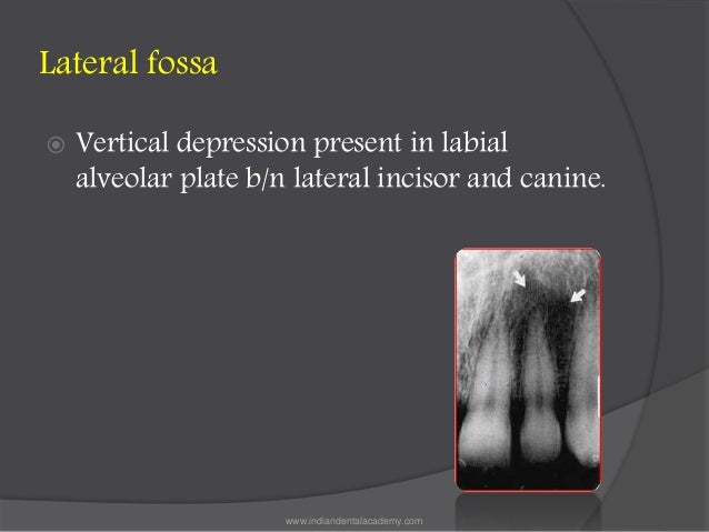 Inter radicular radiolucencies / dental courses