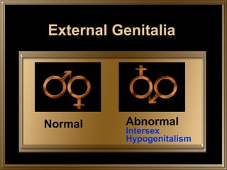 Intersex | PPT