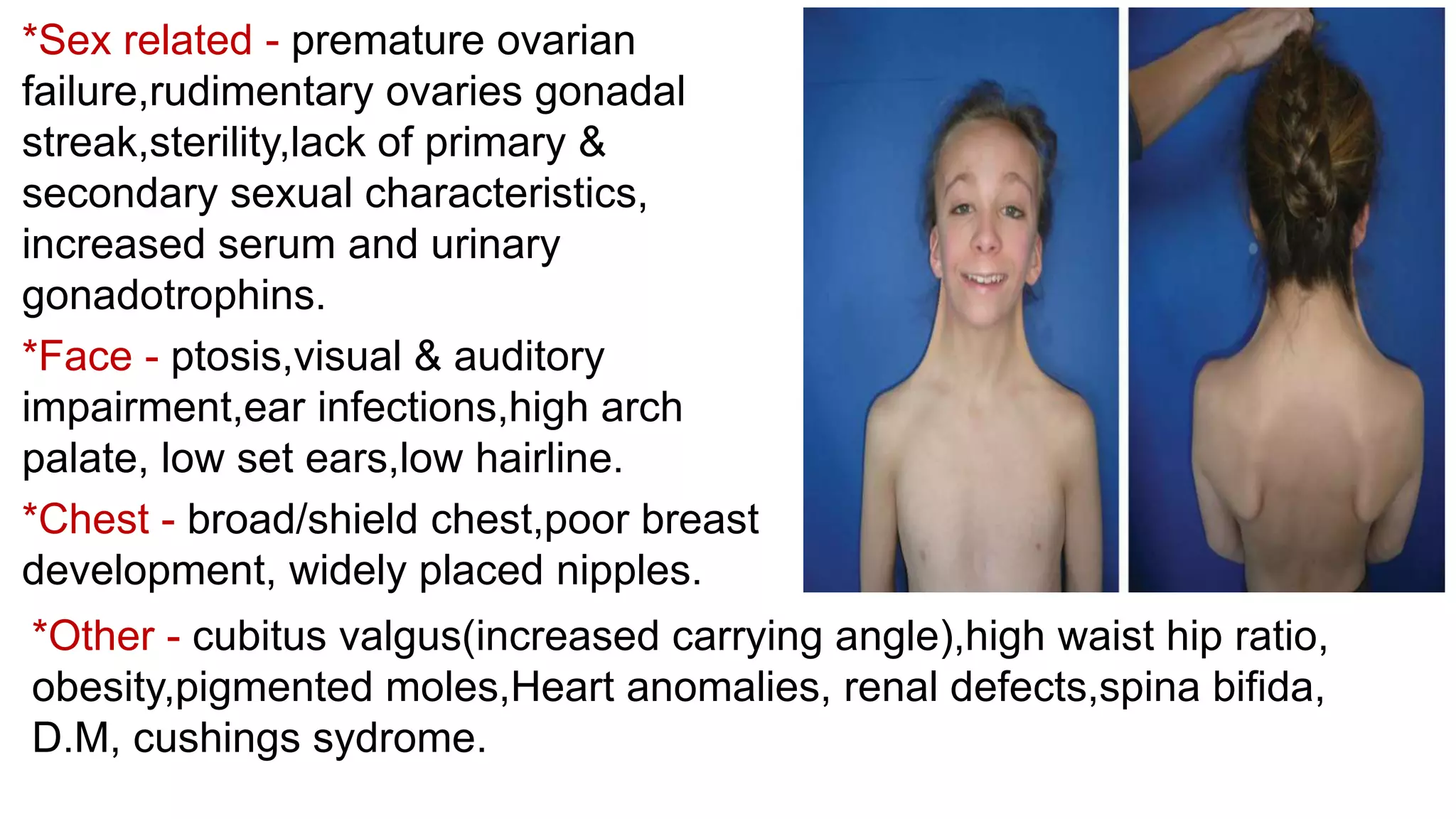 Intersex Forensic Medicine Pptx