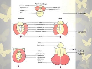 Intersex Chart