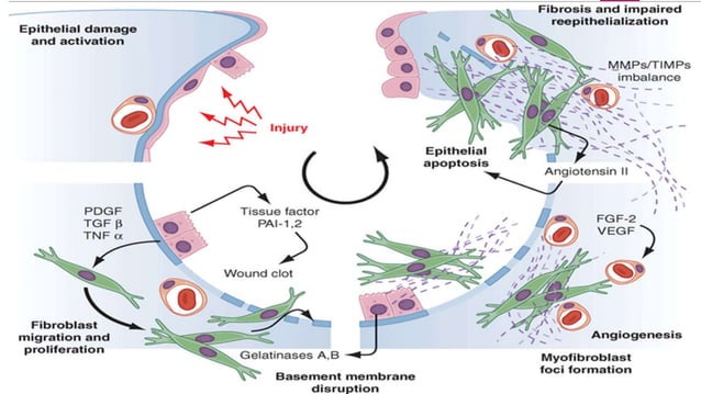 interstial lung deases.pptx