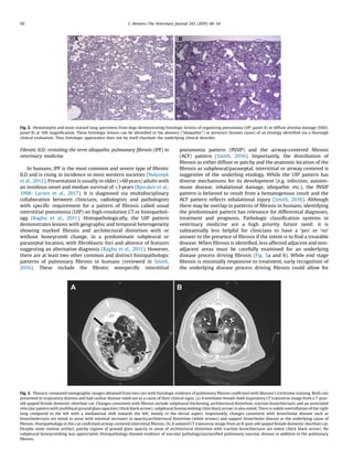 Intersticial lung Disease I.pdf