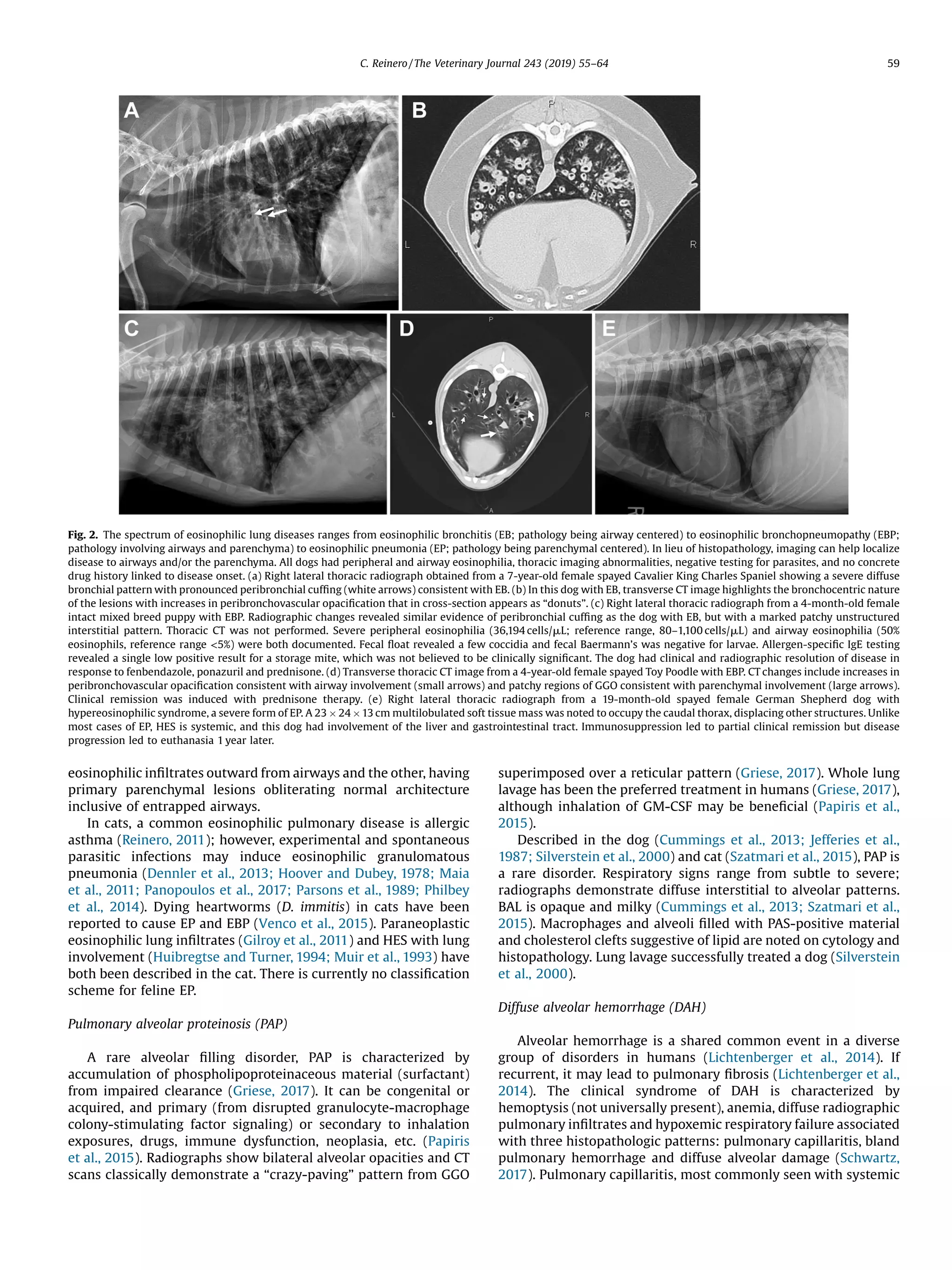 Intersticial Lung Disease II.pdf