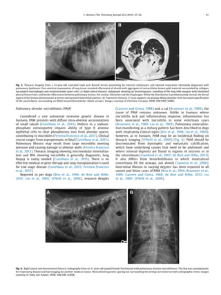 Intersticial Lung Disease II.pdf